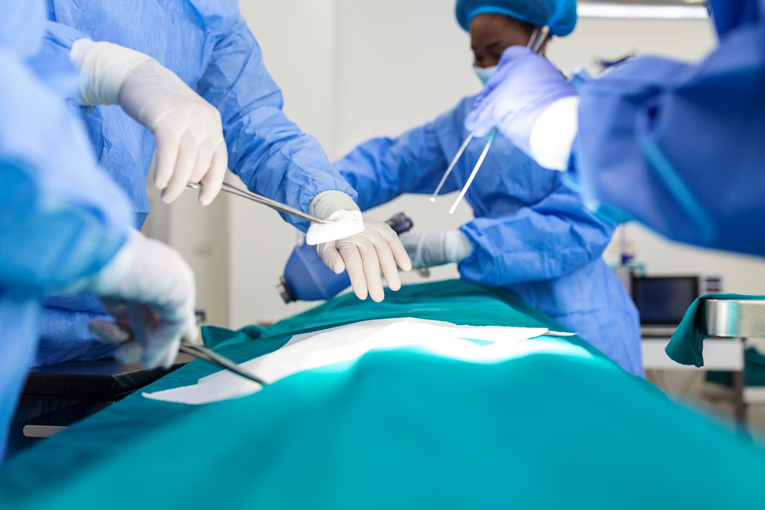 All About Laparoscopic Gallbladder Removal Surgery (Laparoscopic ...